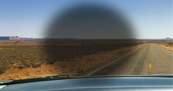 What are Dark Spots in Vision? – OPTICAL SOLUTIONS Your Trusted Eye ...